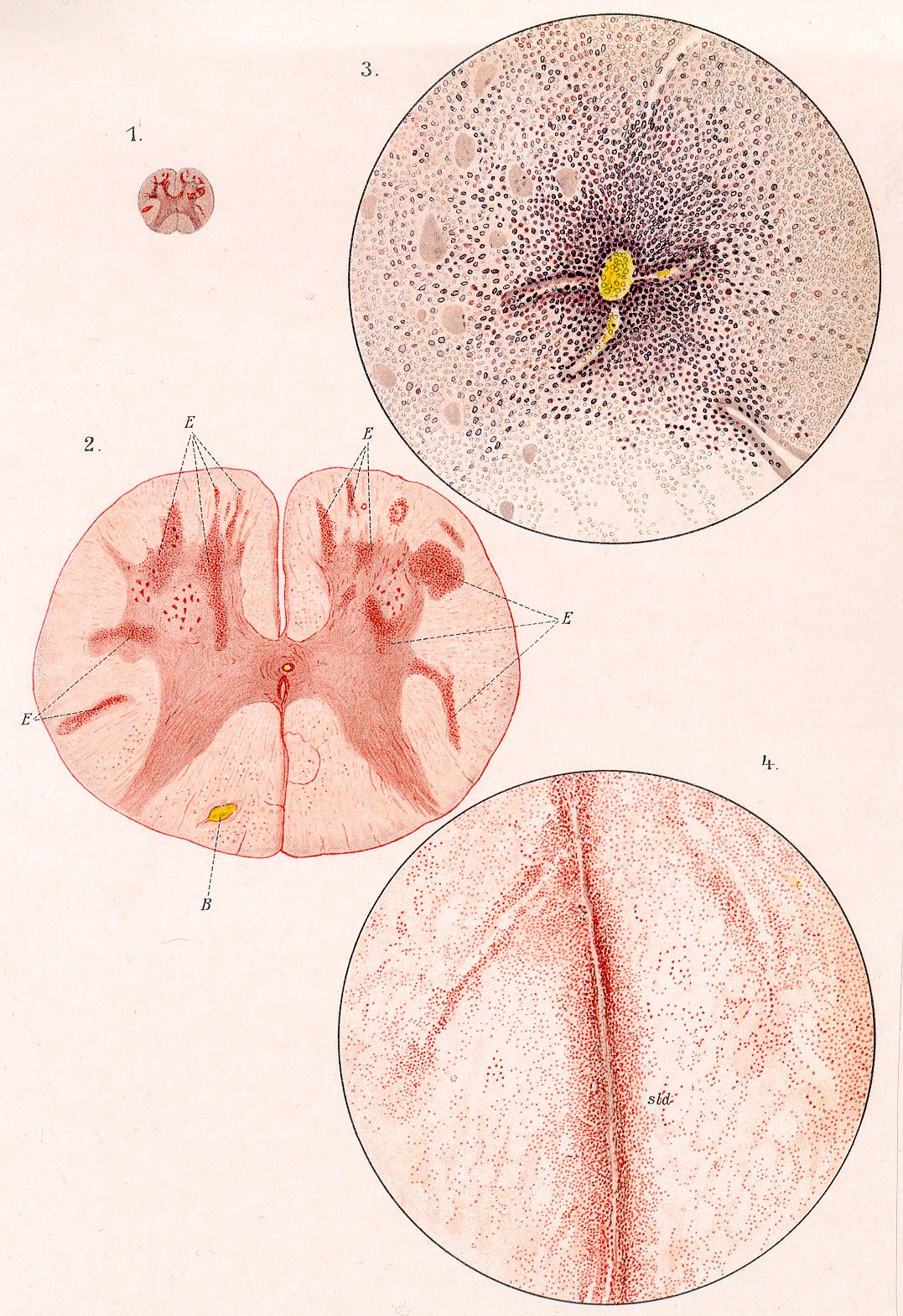 Smallpox: the Plague Humanity Defeated - Biographies by Biographics